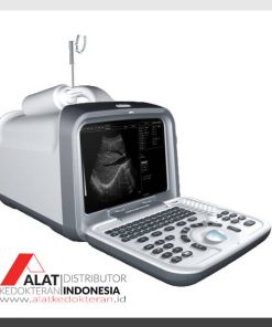 USG | Jual USG 2D 3D 4D Color Doppler Portable Terpercaya