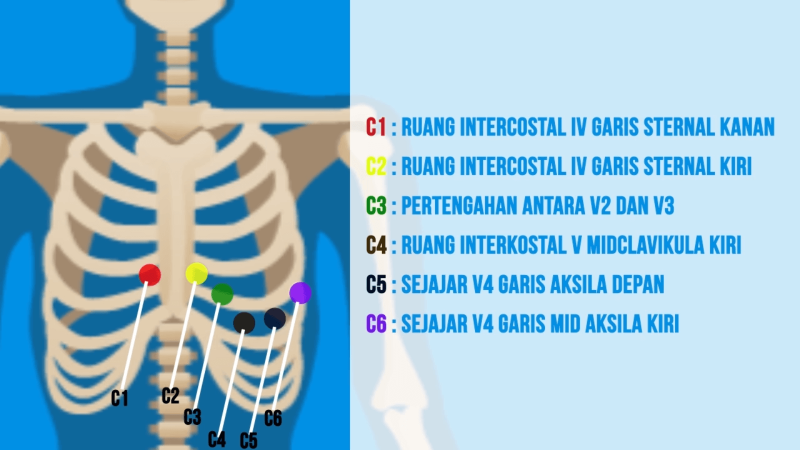 Kegunaan Alat EKG iMAC 120 dari ZONCARE | Alat kedokteran ID