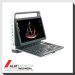 USG | Jual USG 2D 3D 4D Color Doppler Portable Terpercaya